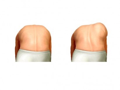 Oktober 2017 | Cesar Dynamiek